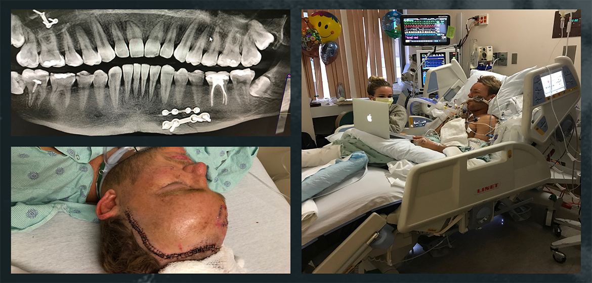 Crâne fracturé et mâchoire cassée : le retour à la vie de Dusty Payne